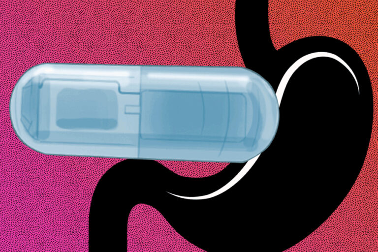 MIT Researchers Design Vibrating Weight Loss Pill That Moves To Induce ...